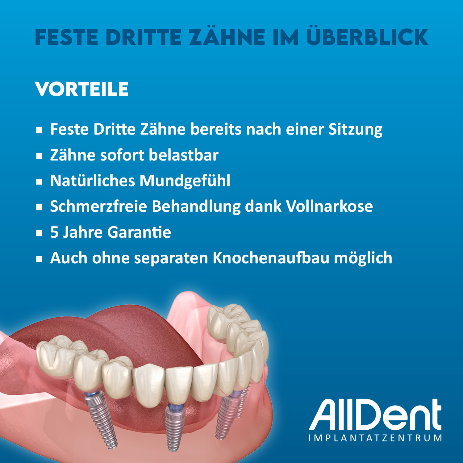 Feste dritte Zähne an einem Tag | Stuttgart